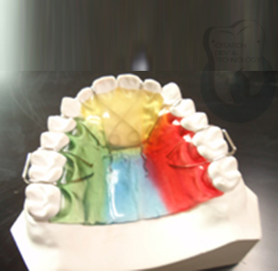 Products / Orthodontics and Retainer / Orthodontic_Creation Dental ...